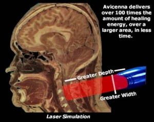 Laser Therapy Biological Effects - High Power Laser Therapy